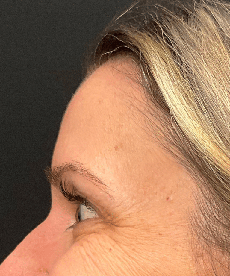 Botox - Oceane Medical Aesthetics and Wellness By Dr. Mark Epstein